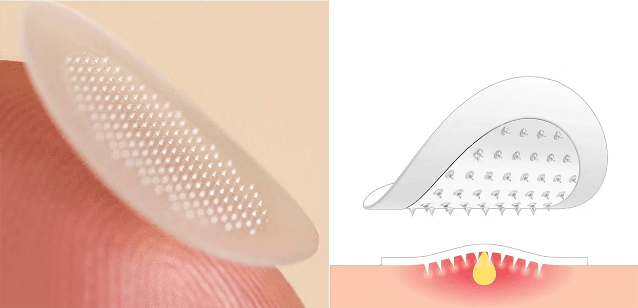 Microneedle Acne Patch OEM Guide for Skincare Brands